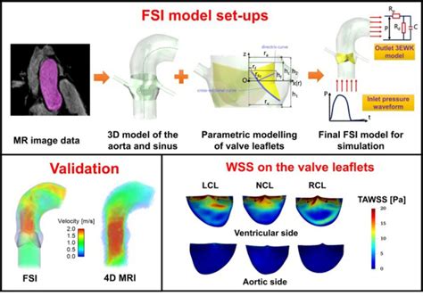 Fluidstructure Interaction Analysis Of A Healthy Aortic Valve And Its Surrounding Haemodynamics