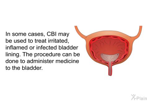 Continuous Bladder Irrigation