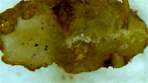 Dandelion Nodules And Nodule Cross Sections Under Magnification Free Photos On