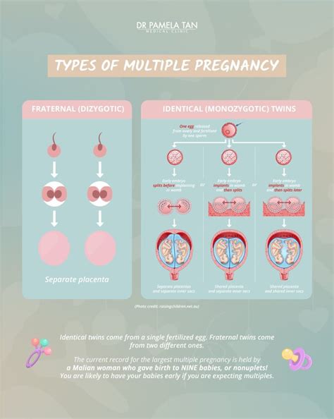 Twin Pregnancy 101 Things To Learn When Expecting Multiples