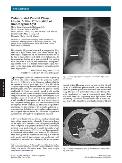 Pedunculated Parietal Pleural Lesion A R Pdf Lung Cardiothoracic Surgery