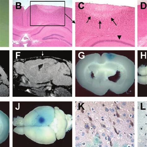 Characterization Of The Lesion Model And Evolution Of The Cortical