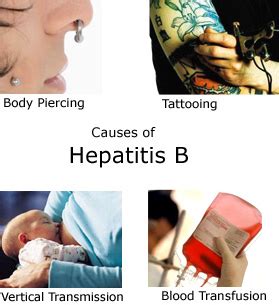 All About Hepatits B Transmission Of Hepatitis B