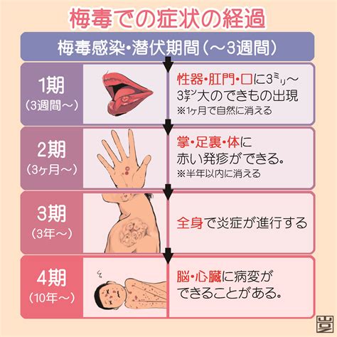 先天梅毒の赤ちゃん