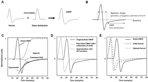 Conduction Block In Ncs At Debra Masters Blog
