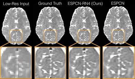 A Visualisation Of Mean Diffusivity Maps On An Axial Slice On A Test