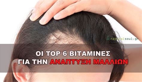 Οι 6 καλύτερες βιταμίνες για πλούσια μαλλιά Η 2 είναι απαραίτητη Τα μαλλιά μας είναι πολύ