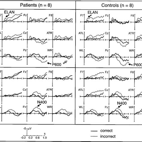 Average Event Related Brain Potentials For The Syntactic And Semantic Download Scientific