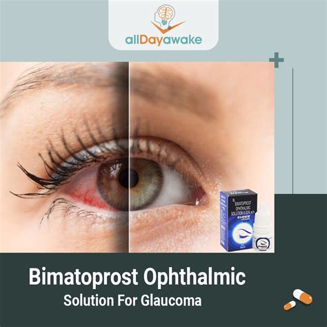 Bimatoprost Ophthalmic Solution For Glaucoma