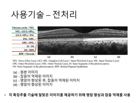 Retinal Layer Segmentation Pdf