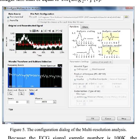 Figure 1 From Design Of Ecg Signal Acquisition And Processing System Semantic Scholar