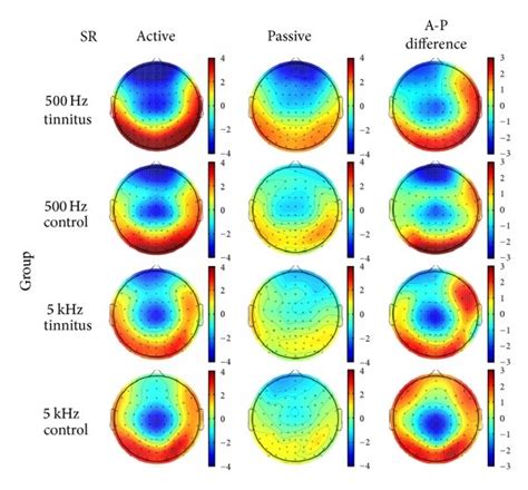 N2 And Auditory Sr Scalp Topography And Attention Effects A Effect