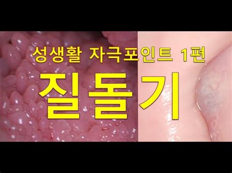 질돌기 질주름 관계시 자극포인트 질점막 돌기주름에 대한 자세한 설명과 3차원질성형으로 질돌기형성하는 방법 수술전후 사진비교