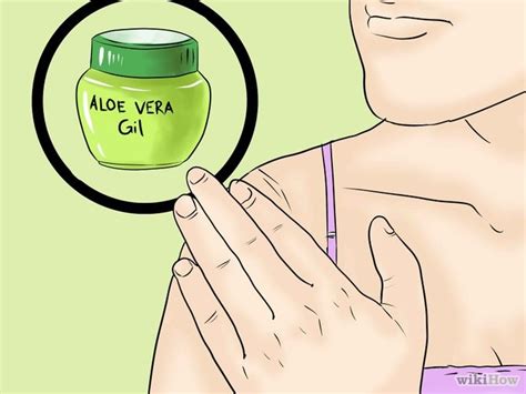 How To Get Rid Of A Rash With Pictures WikiHow