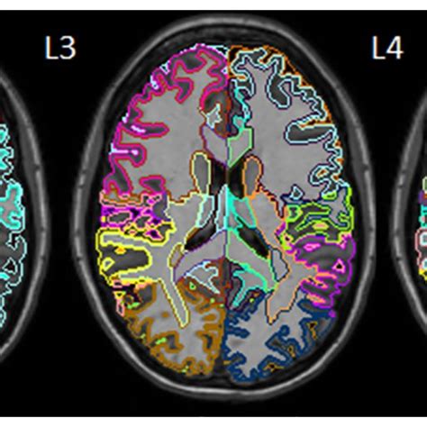 Brain Parcellation Scheme Of The Jhu Multiple Atlases Multiple