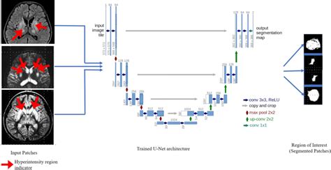 Wd Image Segmentation Using U Net Architecture Download Scientific Diagram