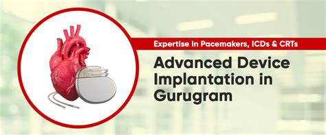 Device Implantation For Heart Rhythm Disorders Dr Anil Dhall Gurugram