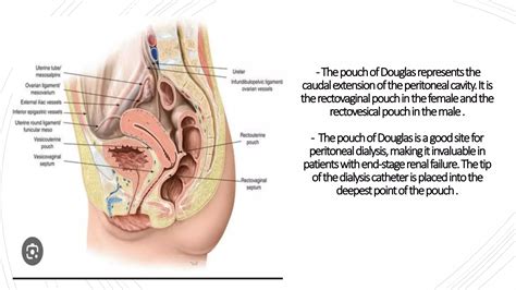 Rectouterine Pouchpptx