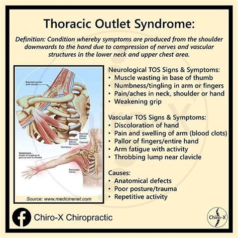 Addisons Test Thoracic Outlet Syndrome Reverse Adsons Test And Thoracic