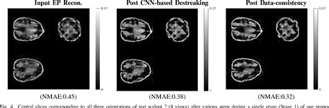 Figure 4 From Sparse View Cone Beam Ct Reconstruction Using Data Consistent Supervised And