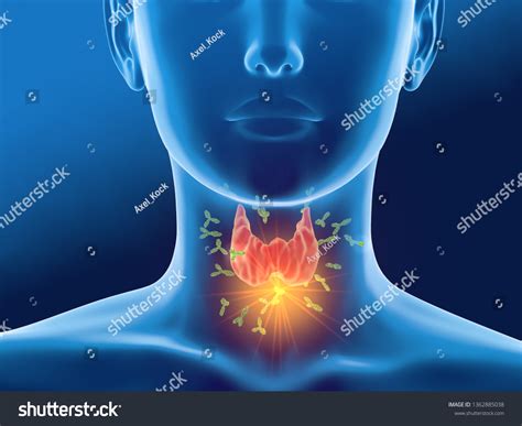 Woman S Healthy Thyroid Over 77 Royalty Free Licensable Stock