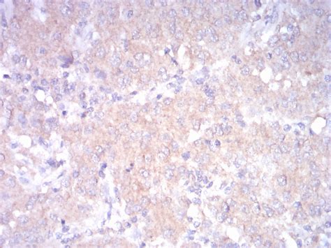 Ldlr Antibody Purified Mouse Monoclonal Antibody Wb Ihc Fc E Buy