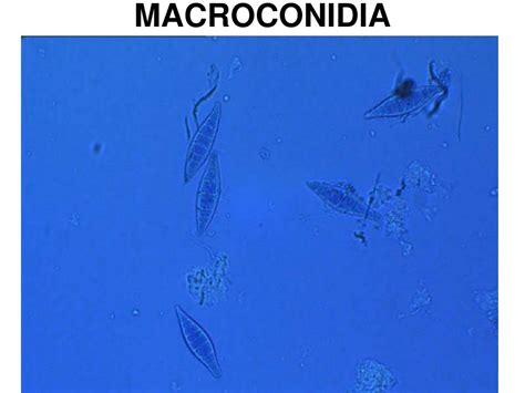 Ppt Mycology Powerpoint Presentation Free Download Id 630488