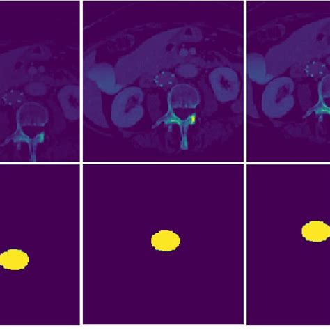 Unet Model Architecture Used For The Training Phase To Generate A