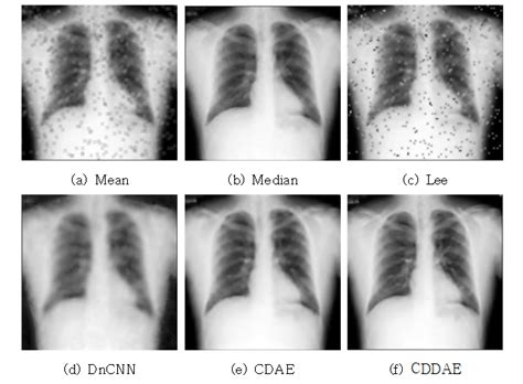 github eonseungseong image denoising with cddae convolutional dual
