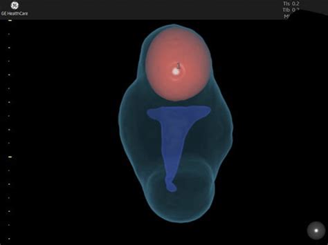 Voluson™ Expert 20 Ultrasound System Ge Healthcare