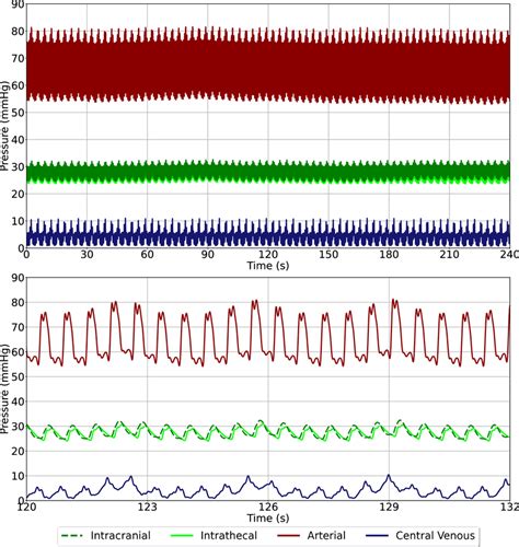 Top Representative Baseline Waveforms Observed Pre Infusion Please Download Scientific