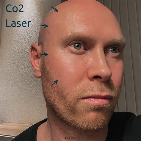 Gitte Moulin Home Facebook