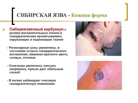 Зоонозы Морфология презентация онлайн