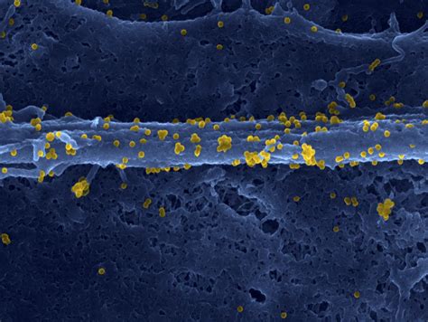 Identified A Protein Essential For Chikungunya Virus Replication