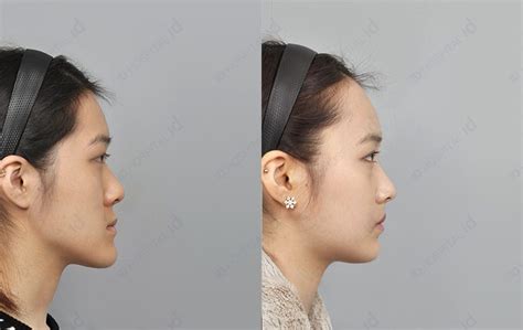 Список операций