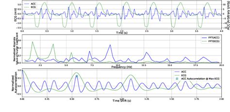 Figure 1 From Accelerometry Based Classification Of Circulatory States During Out Of Hospital