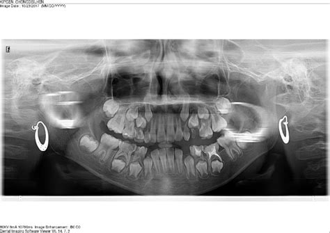 Object Detection Object Detection Dataset By Abu1