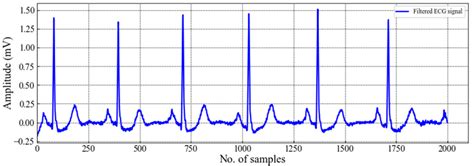 Ecg Signal Denoising A Before Filtering And B After Filtering