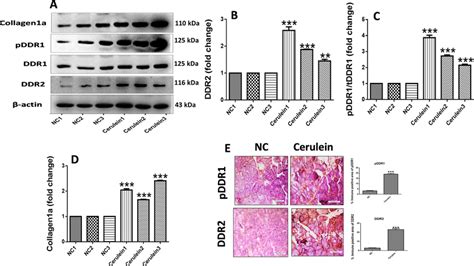 Upregulation Of Ddr1 And Ddr2 In Pancreatic Fibrosis A D Western Download Scientific Diagram