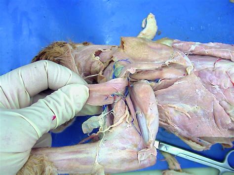 Upper Limb Dissection Cat 4 Diagram Quizlet