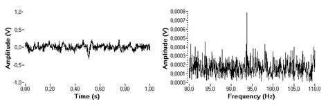 An Example Of An Auditory Steady State Response Assr Evoked By A