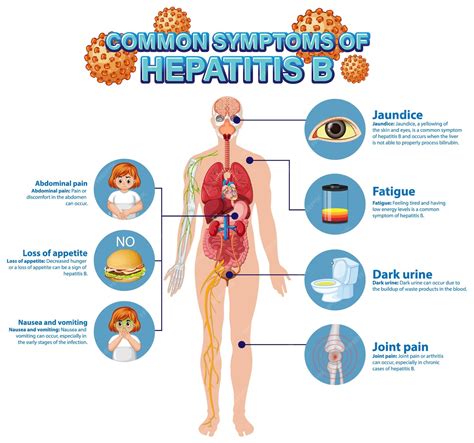 Cartel Informativo De Síntomas Comunes Hepatitis B Vector Premium