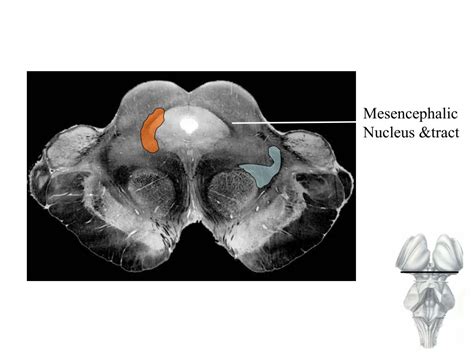 Ppt Trigeminal System Powerpoint Presentation Free Download Id 2999930