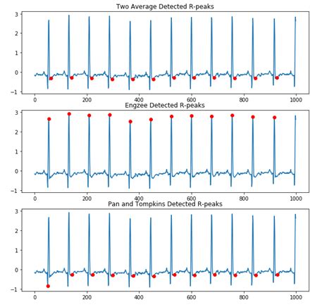 incorrect r peak detection · issue 2 · luishowell ecg detectors · github