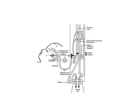 Intracranial Pressure Waveforms And Monitoring Ppsx