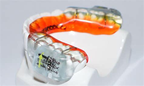 Sleep Apnea Devices New Jersey Sleep Apnea Oral Appliances