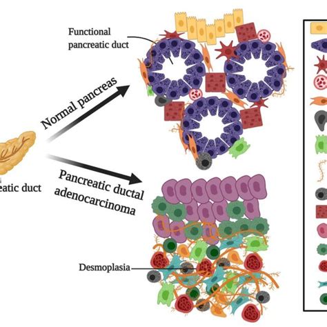 Pancreatic Ductal Adenocarcinoma Microenvironment Normalhealthy Download Scientific Diagram