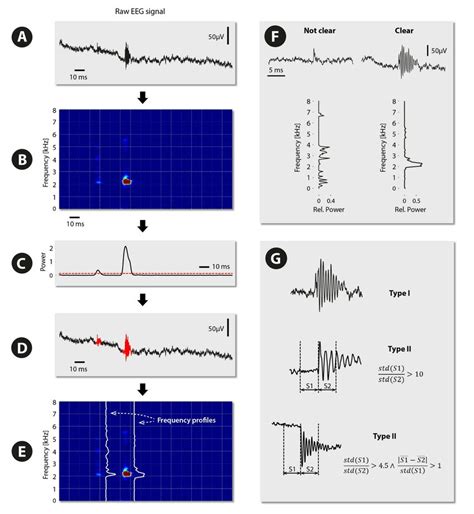 The Figure Introduces The Ufo Detection Method Primary Detection Of
