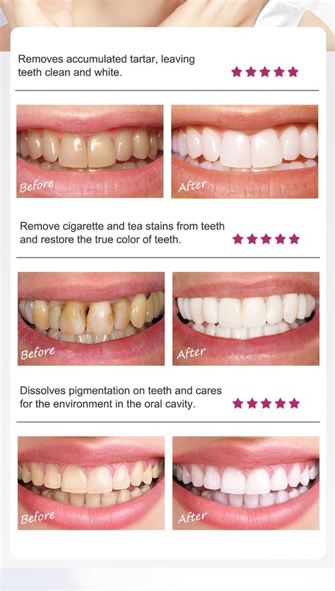 Rtopr Teeth Whitening Essence Pemutih Gigi Wash Yellow Teeth Remove