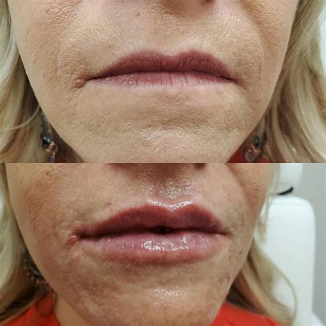 This Beauty Wanted A Aesthetic Elegance And Wellness